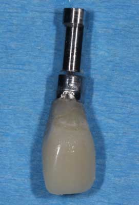 The power of preparation: How to ensure proper gingival zenith position ...