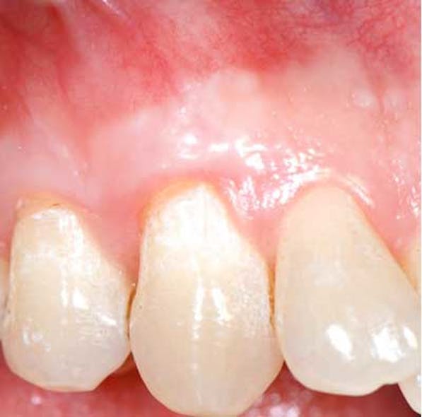 Recession-proof your practice: Increasing patient acceptance of soft ...