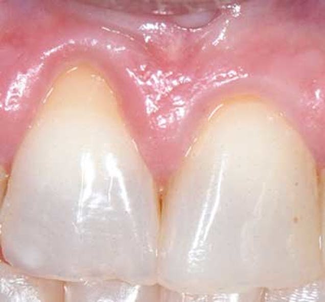 Recession-proof your practice: Increasing patient acceptance of soft ...