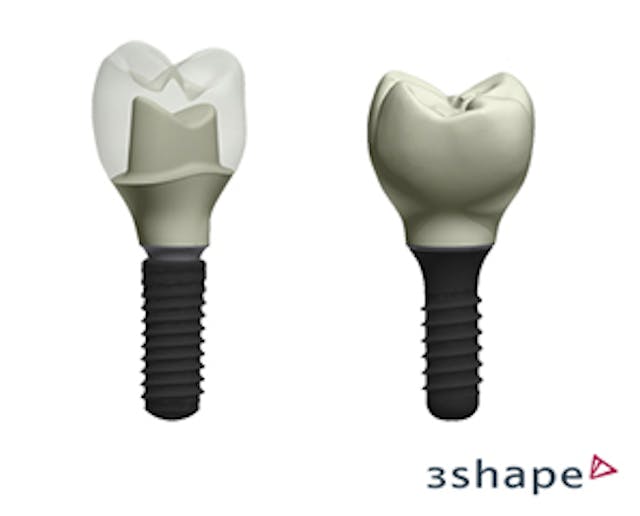 3Shape's Dental System offers CAD design for Straumann Customized ...