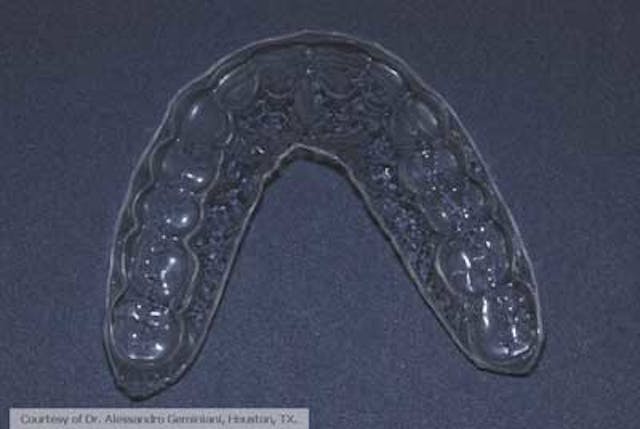 Is it time to retire the free gingival graft procedure in light of new ...