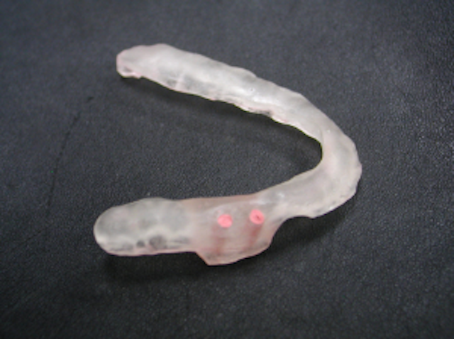 Radiographic guides and surgical guide stents for dental implants ...