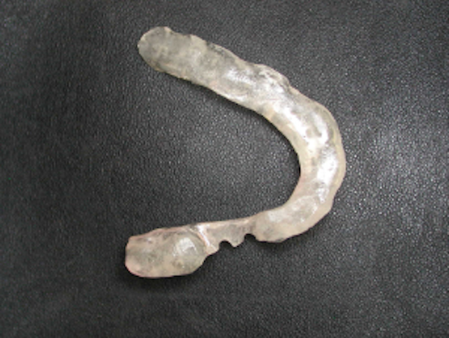 Radiographic guides and surgical guide stents for dental implants ...