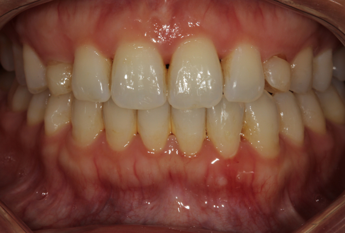 The new classification of periodontal disease that you, your patient ...