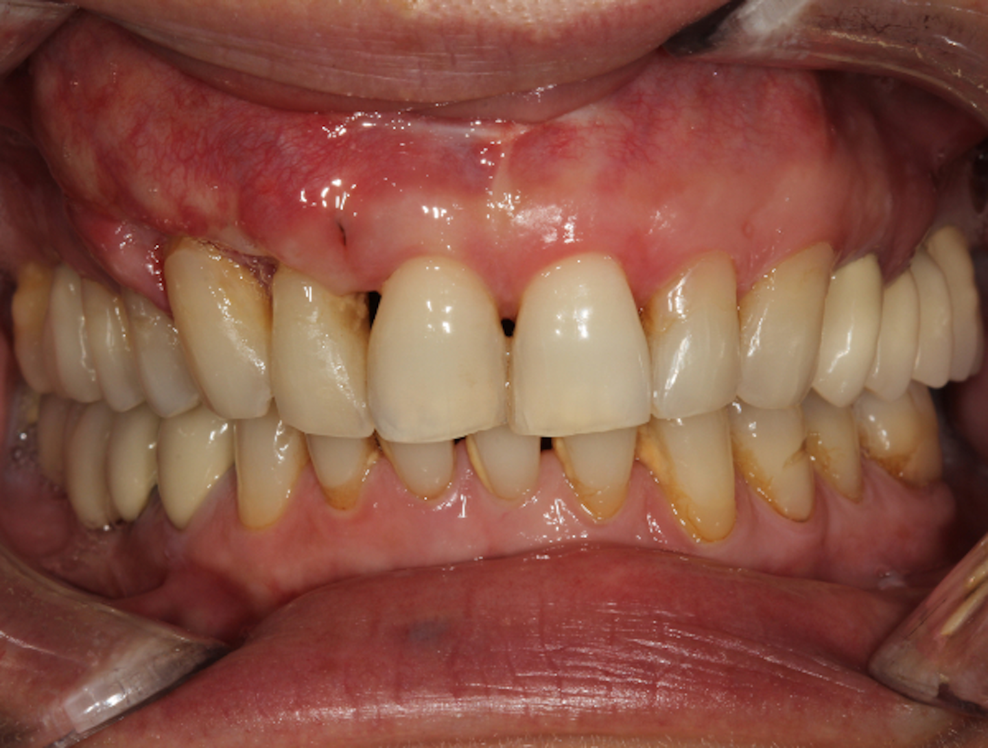 The new classification of periodontal disease that you, your patient ...