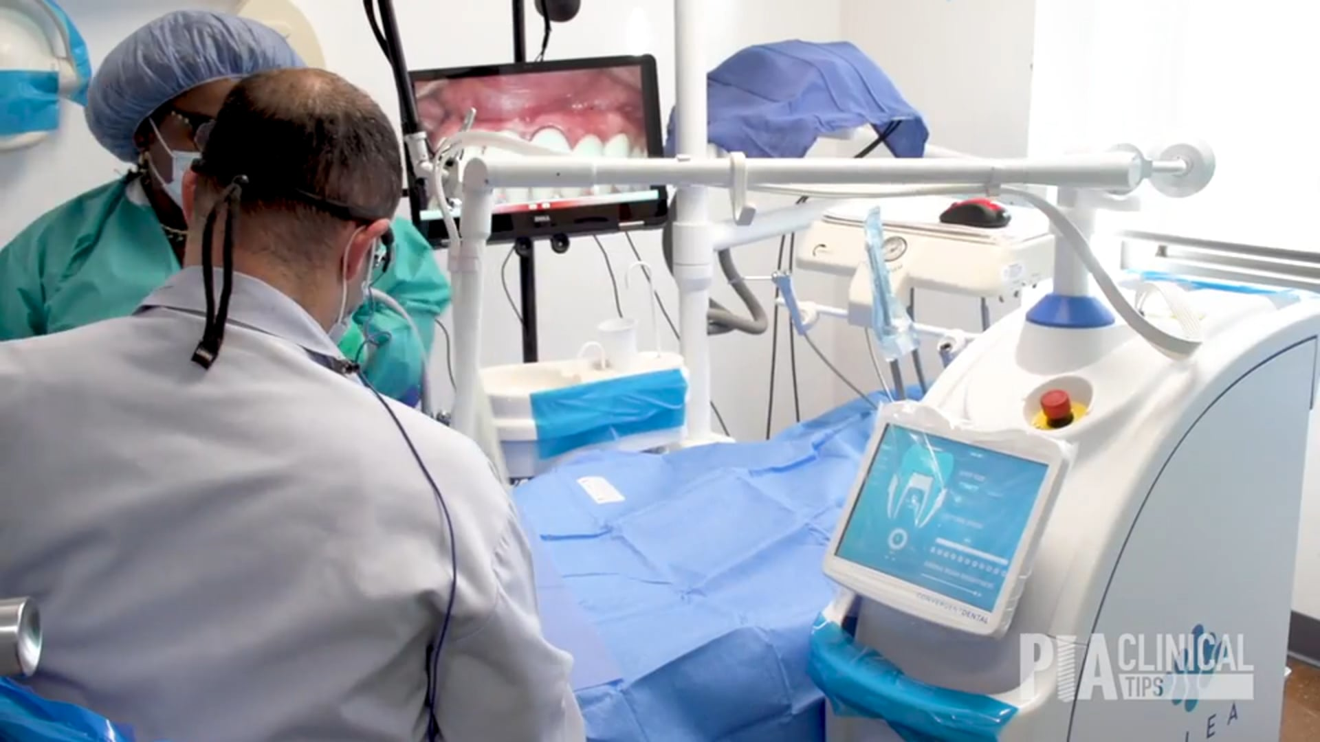 Functional crown lengthening around bleeding crown and veneer ...